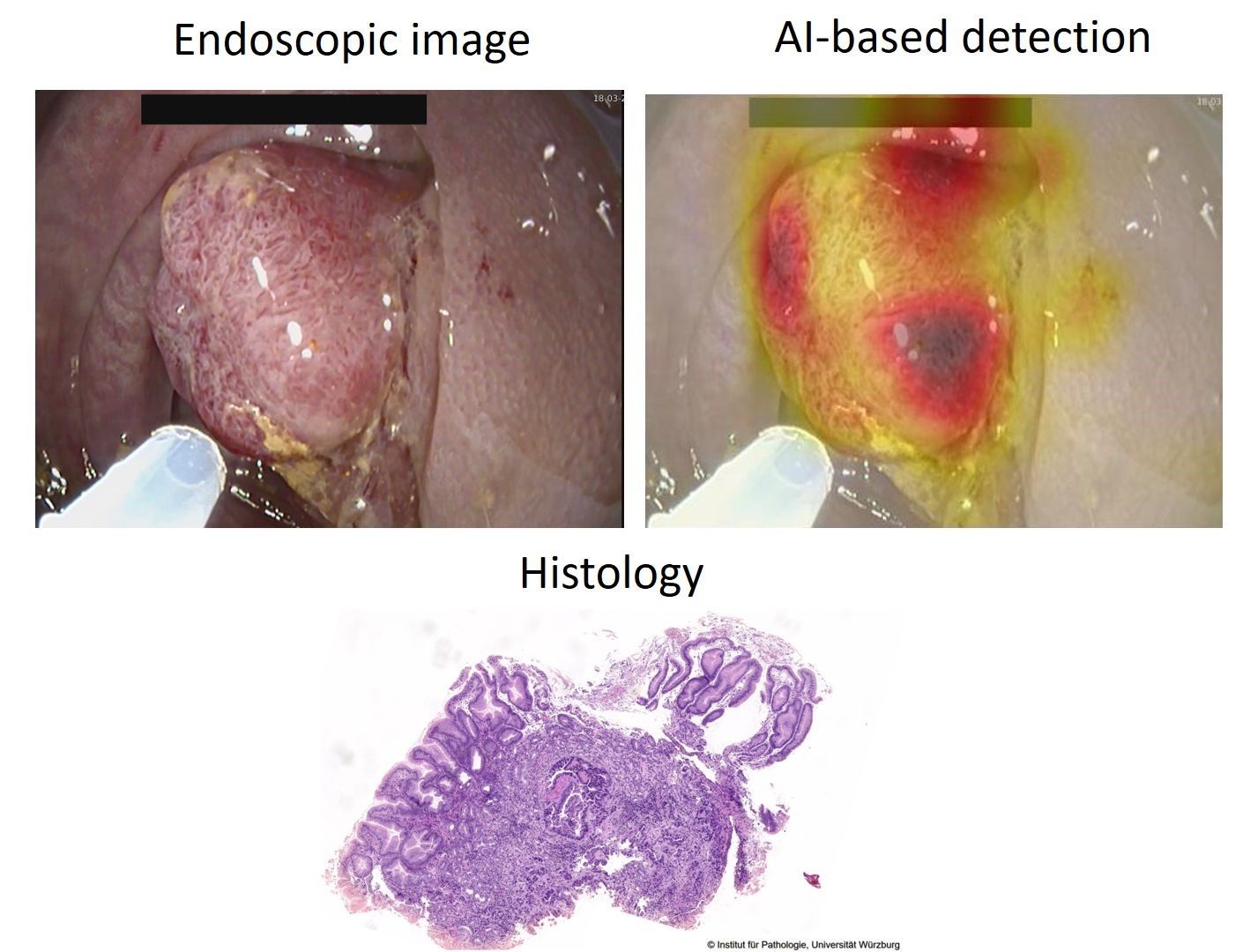 Universitätsklinikum Würzburg: InExEn: Image-guidance in local therapies