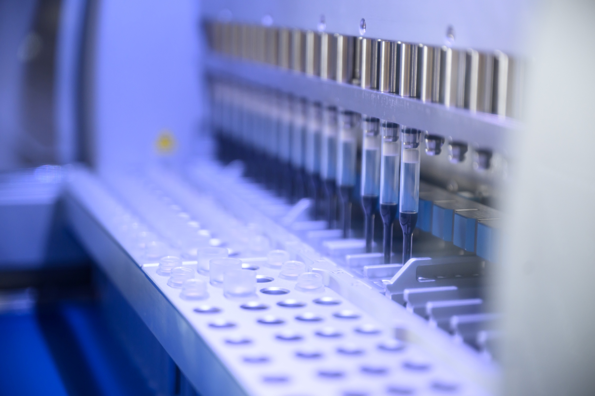 Universitätsklinikum Würzburg: Angst im Genom: Neue genetische ...
